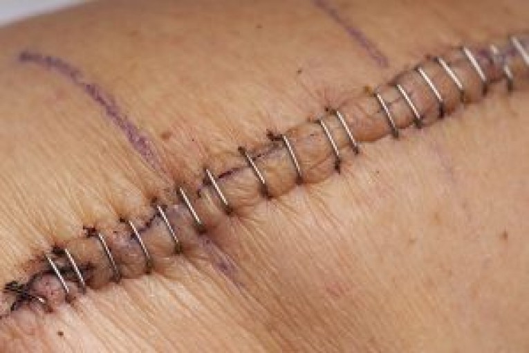 Wound Care Guideline part 1 Dressing Overview Wound Care Guideline part 1 Dressing Overview