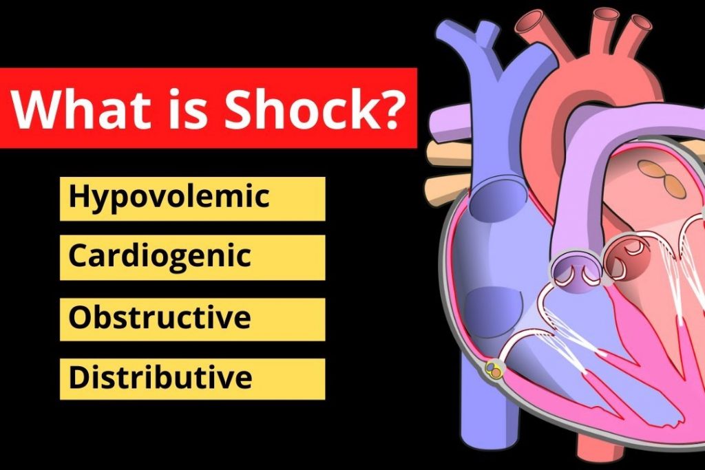 Compensated Shock