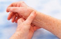 What is pustular psoriasis? Causes, symptoms and treatment