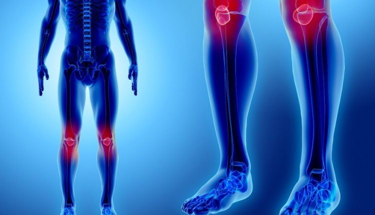 Knee pathologies: patellofemoral syndrome | Emergency Live