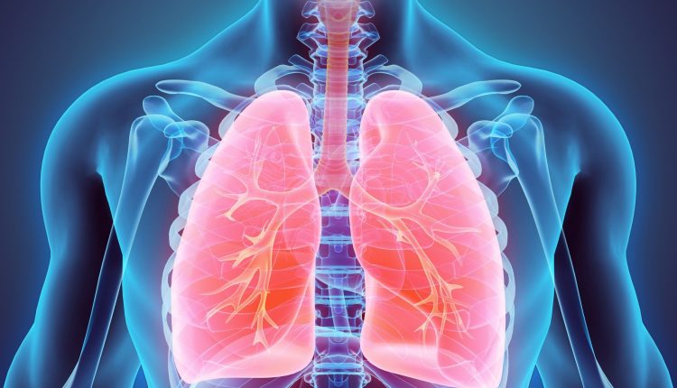 Spontaneous pneumothorax: discussing the collapse of the lungs