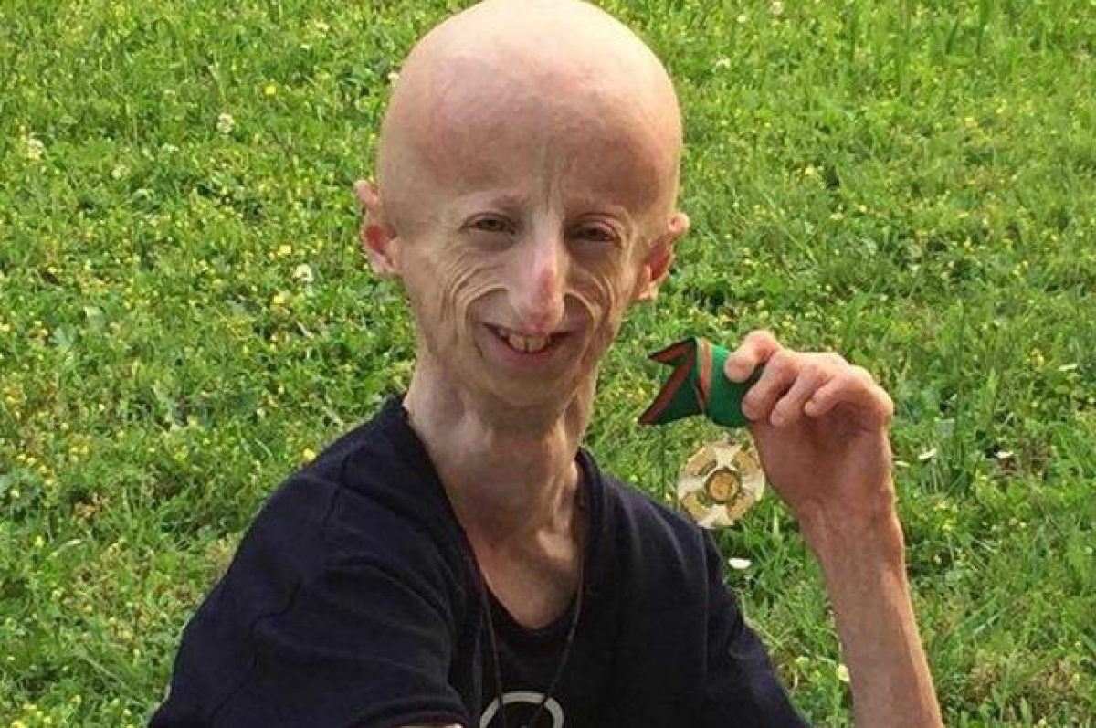 Progeria Therapy