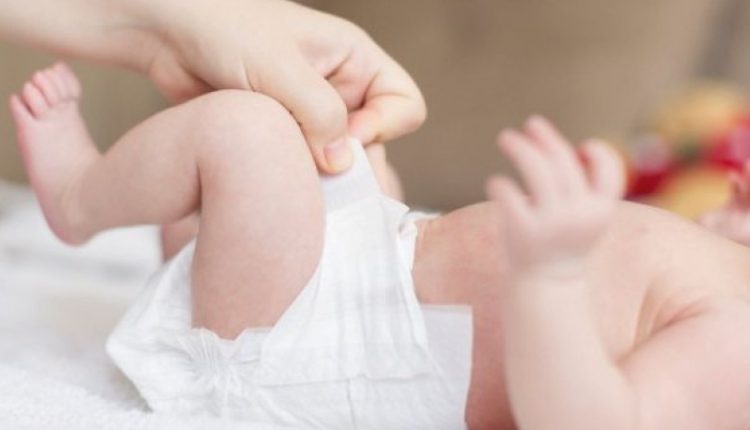 Umbilical hernia in the newborn: what it is and when to intervene