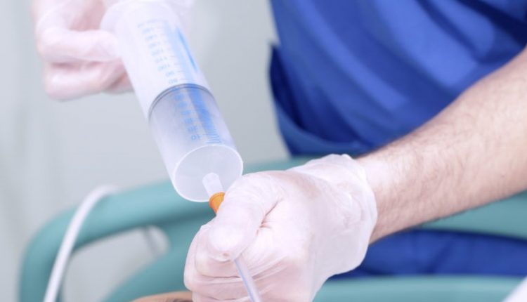 Comment Se Faire Un Lavage D Estomac Maison | Ventana Blog