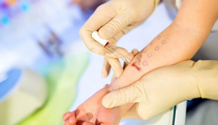 What is the prick-test and what is it for? | Emergency Live