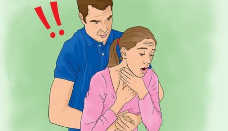 Choking: how to perform the Heimlich manoeuvre