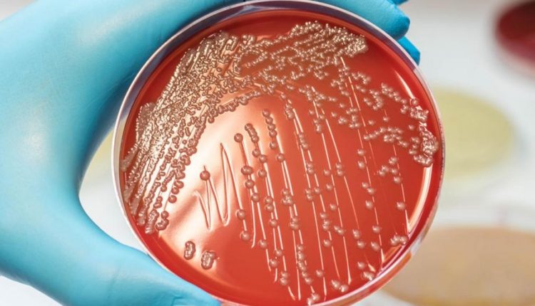 Escherichia coli: symptoms, diagnosis and treatment